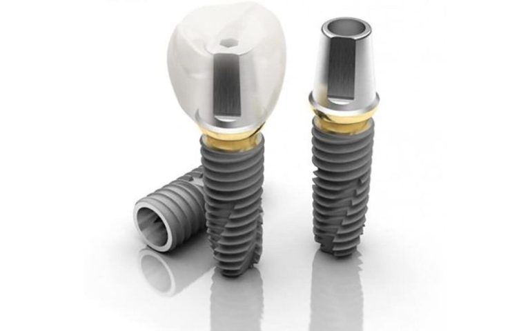 Trụ Implant Osstem Là Gì? Xuất Xứ Nước Nào? Ưu - Nhược Điểm Của Implant ...