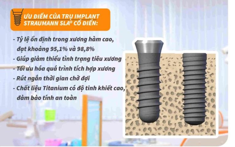 Trụ Implant Straumann Là Gì? Xuất Xứ Từ Nước Nào? Giá Bao Nhiêu?
