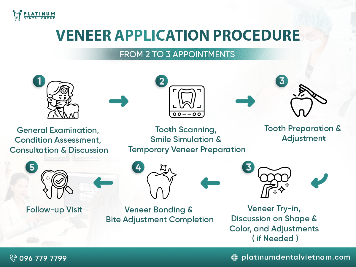 Veneers for Spaced Teeth: Understanding Methods and Techniques ...