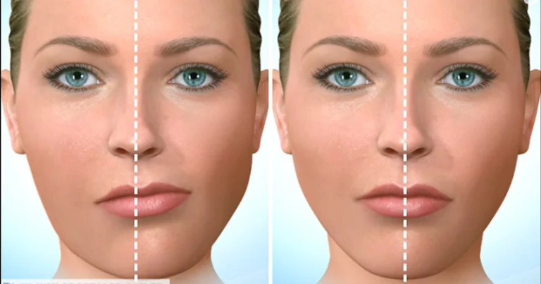 Orthognathic Surgery Before and After: Photos & Case Studies